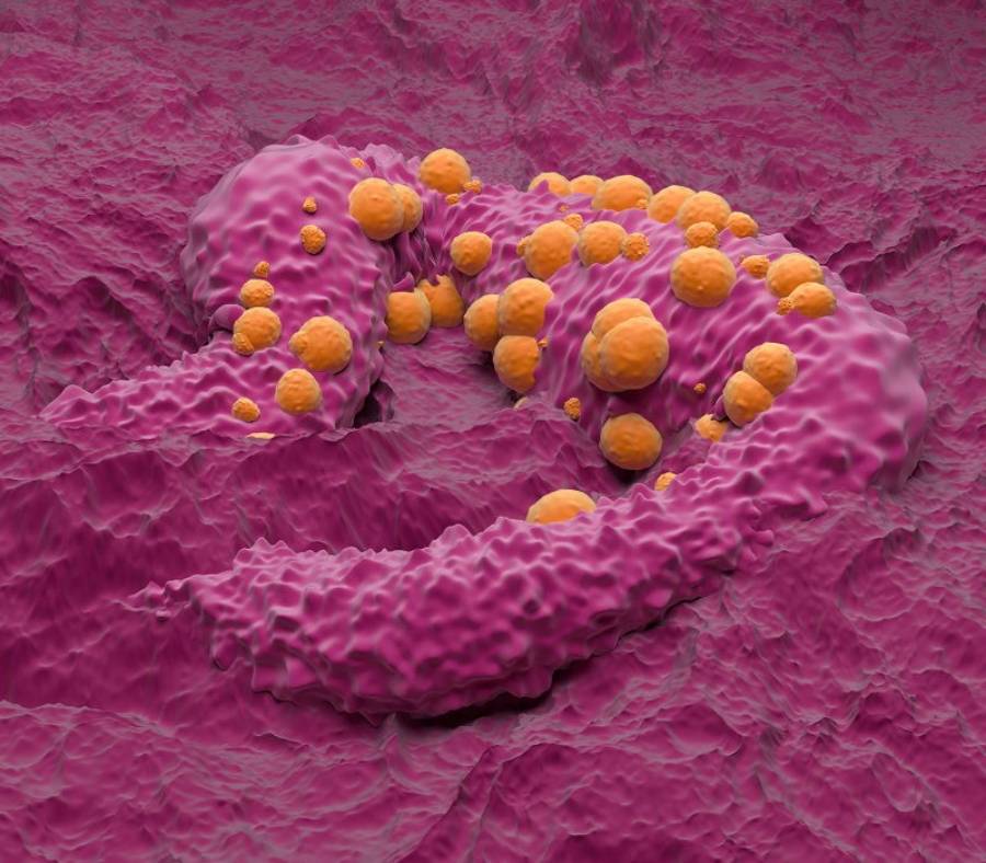 Síntomas de cáncer de piel y tratamientos | Tu canal de salud