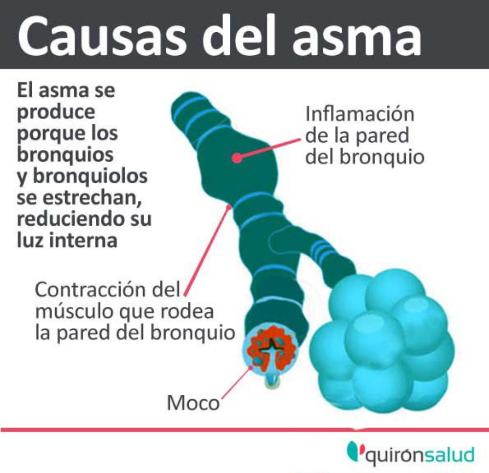 Causas del asma y cómo identificarlo | Tu canal de salud