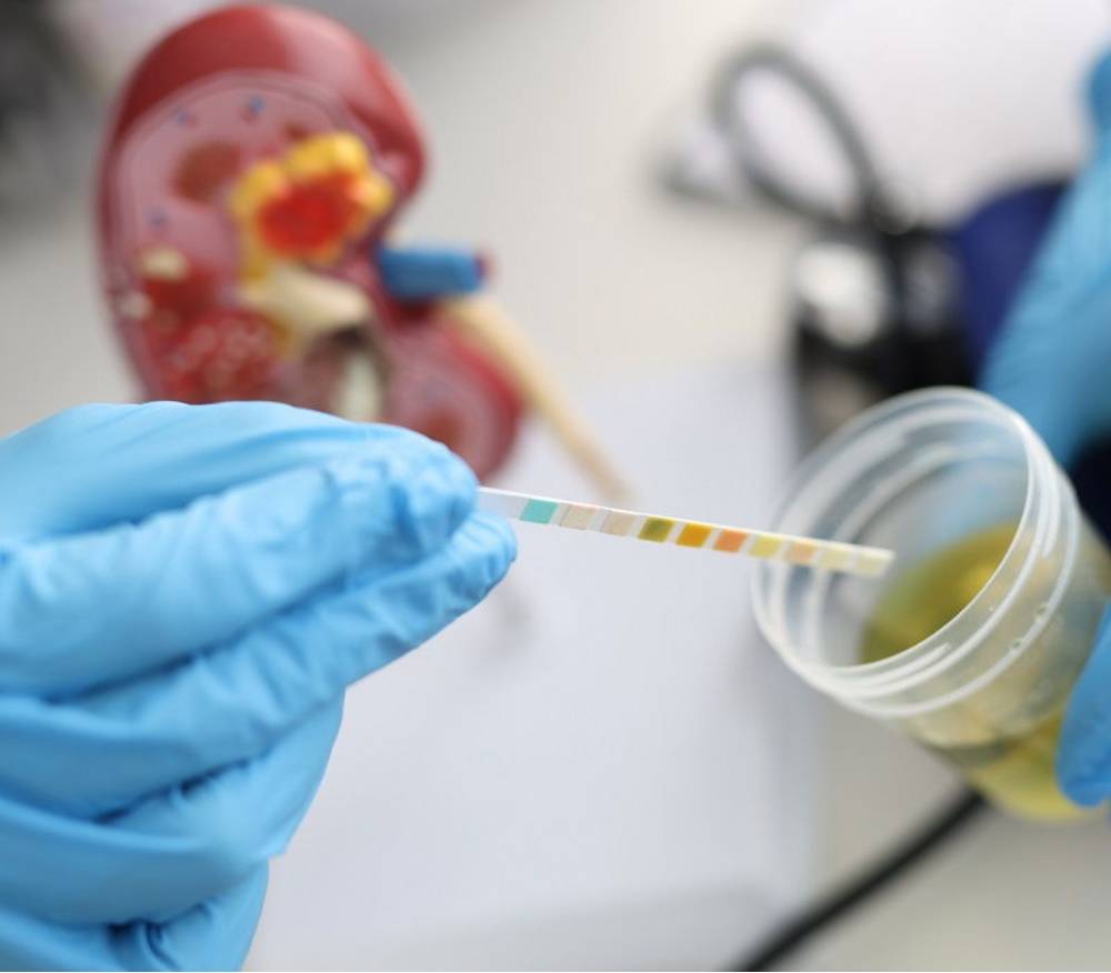 Cistitis recurrente: causas y tratamiento | Tu canal de salud